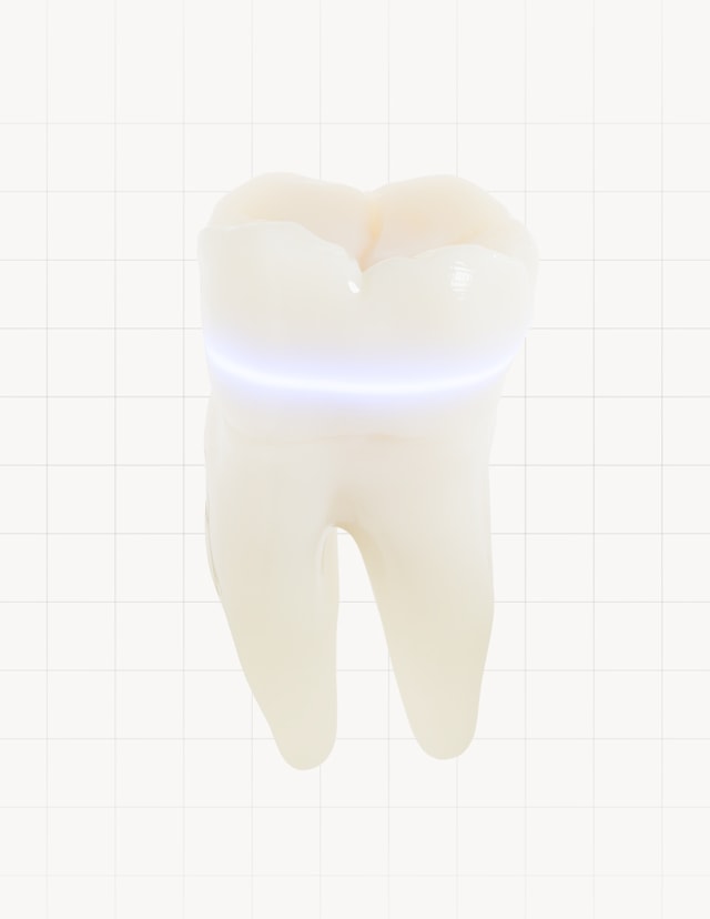 Full-Mouth X-Ray | Overjet Dental Glossary