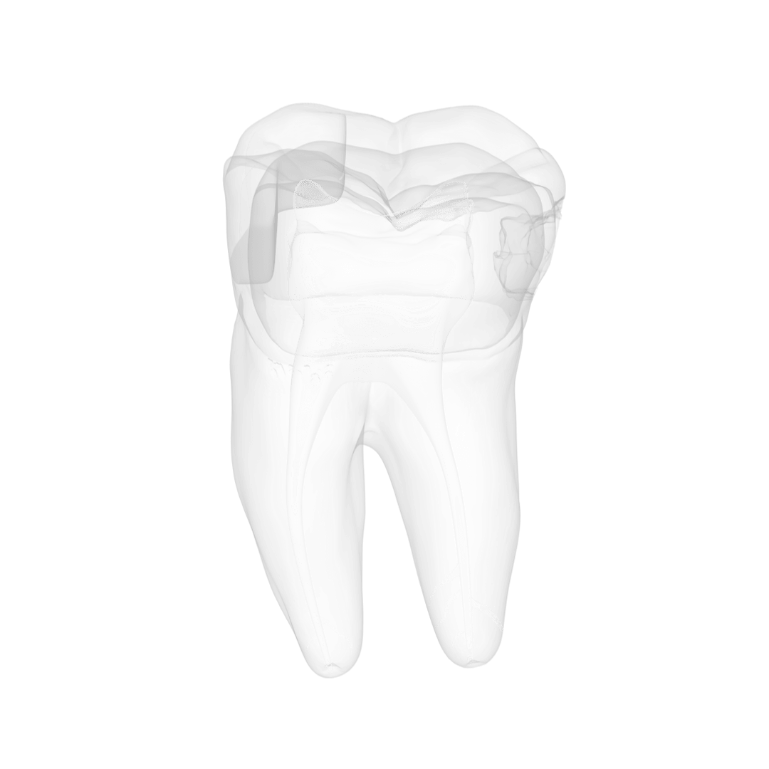 Dental AI Software for DSOs | Overjet