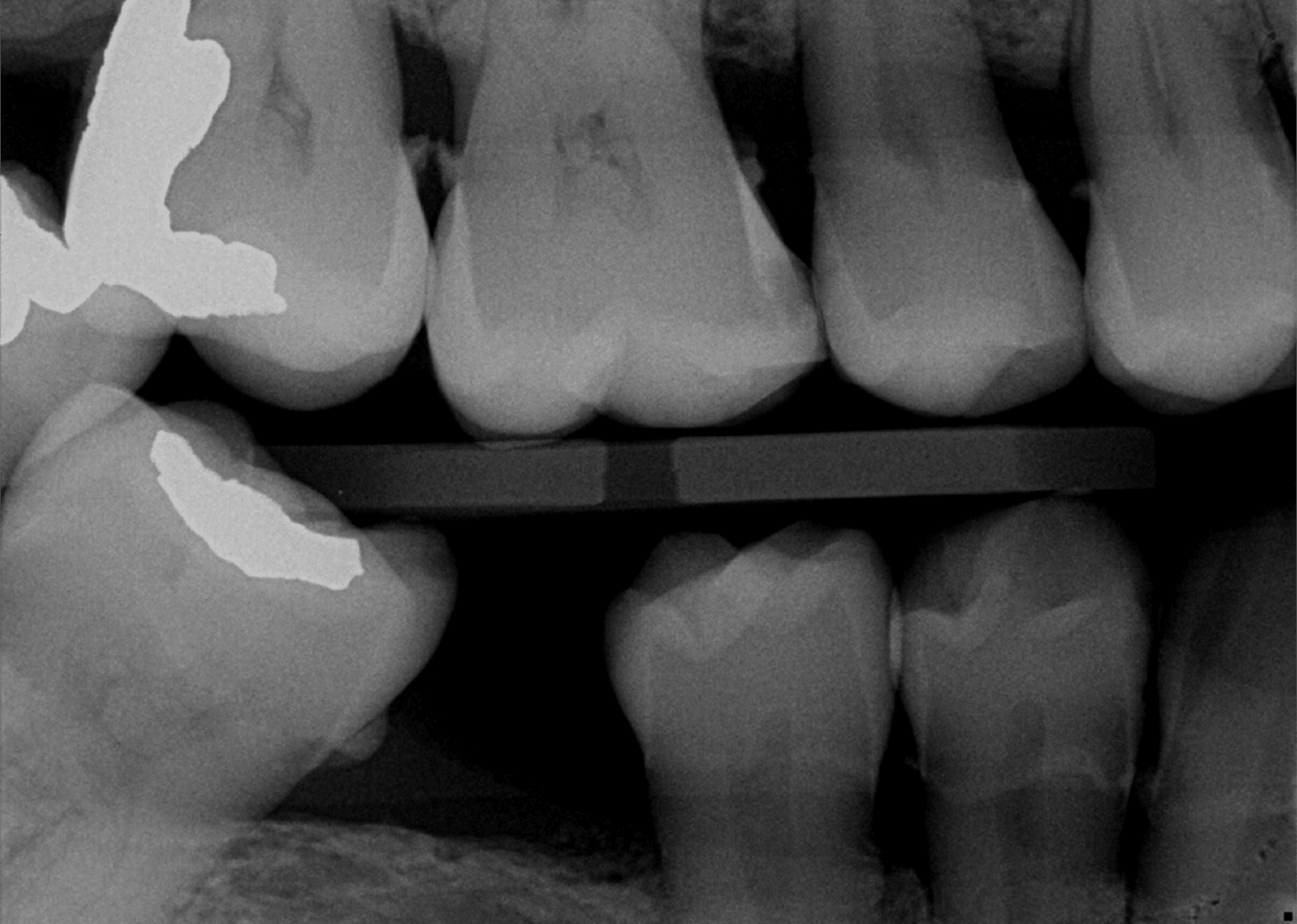 Dental AI Software: Complete Platform for Dental Radiographs, Diagnosis ...