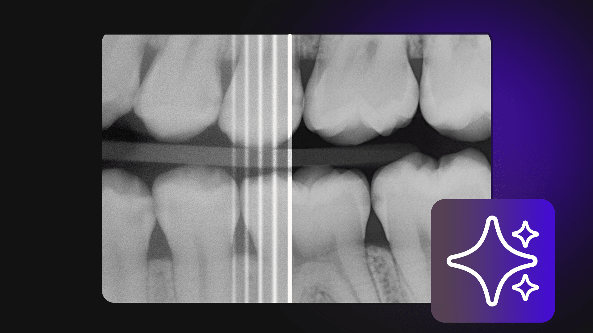 Overjet Earns FDA Clearance to Enhance Dental Images with AI