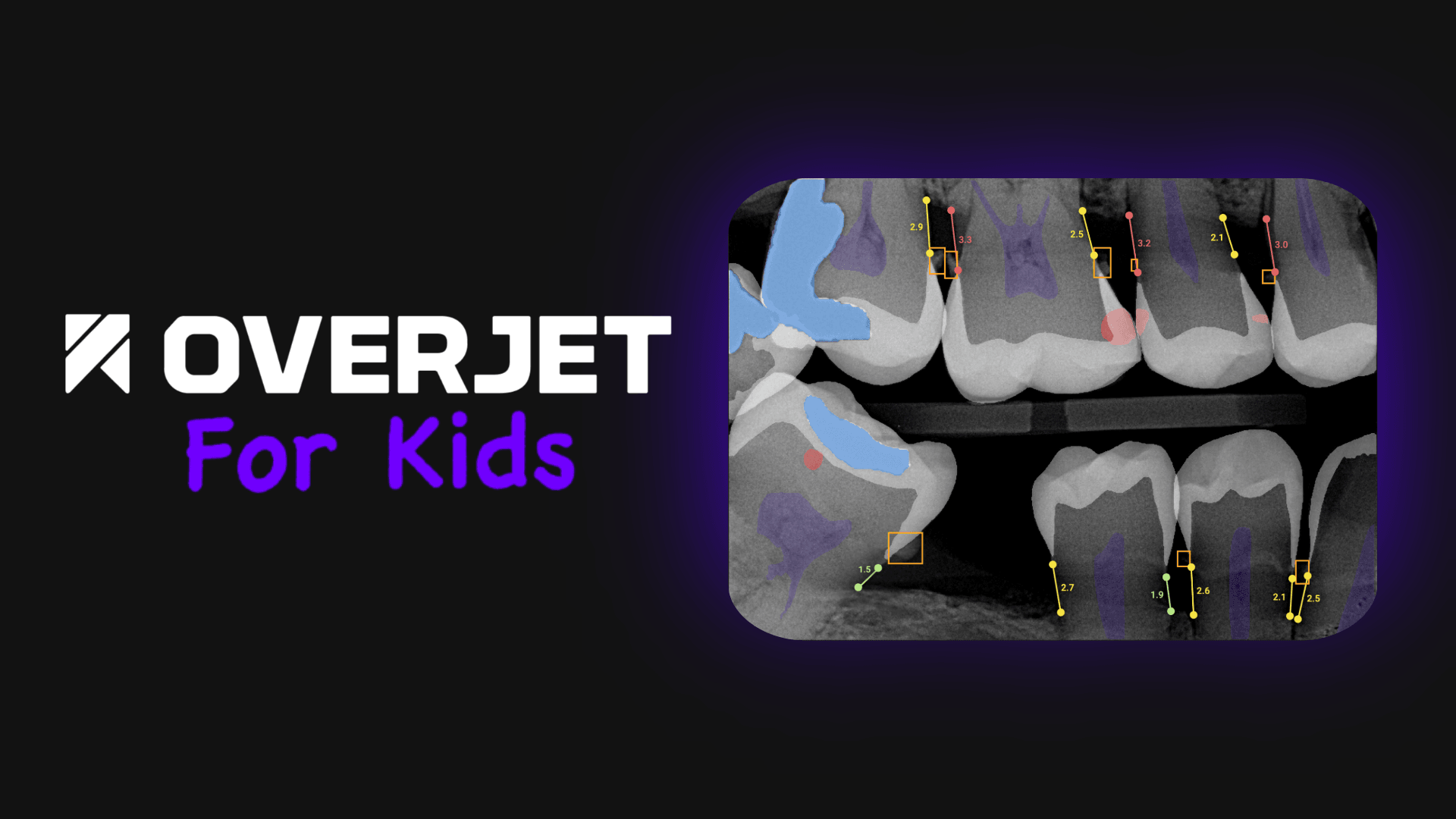 Resources | Overjet - The #1 Dental AI Platform for Providers & Payers