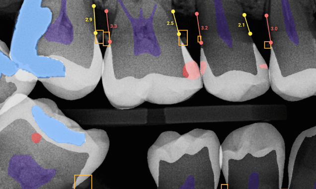 Dental AI Software for DSOs | Overjet