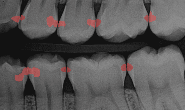 Dental AI Software for DSOs | Overjet