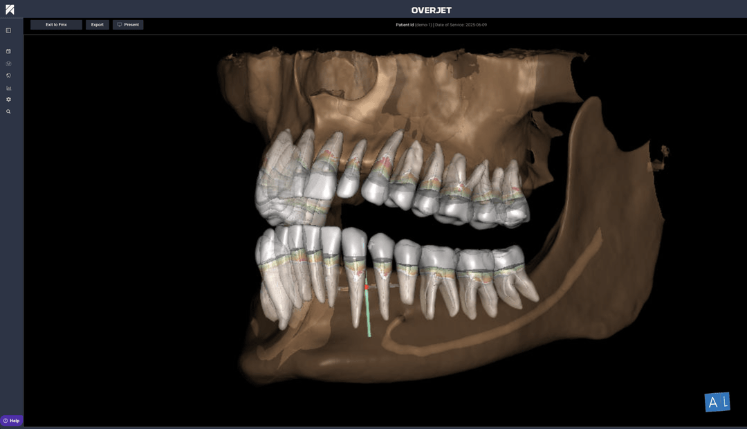 Overjet Announces New FDA Clearance for CBCT 3D Imaging